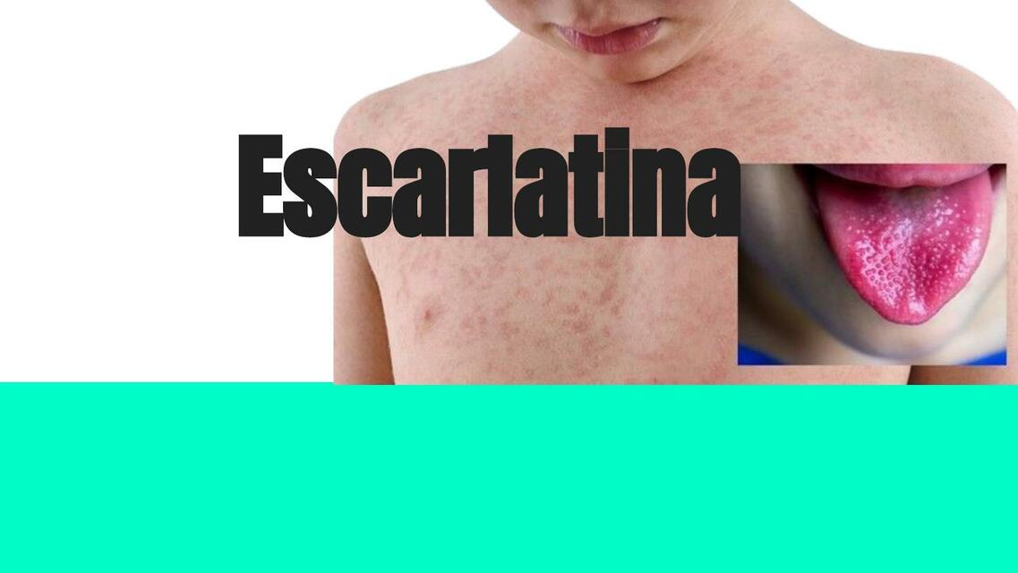 ESCARLATINA | Lupita | uDocz