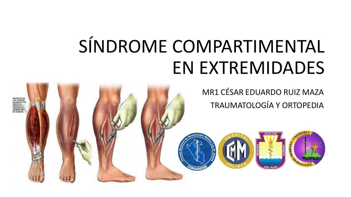 sd compartimental | Cesar Eduardo | uDocz