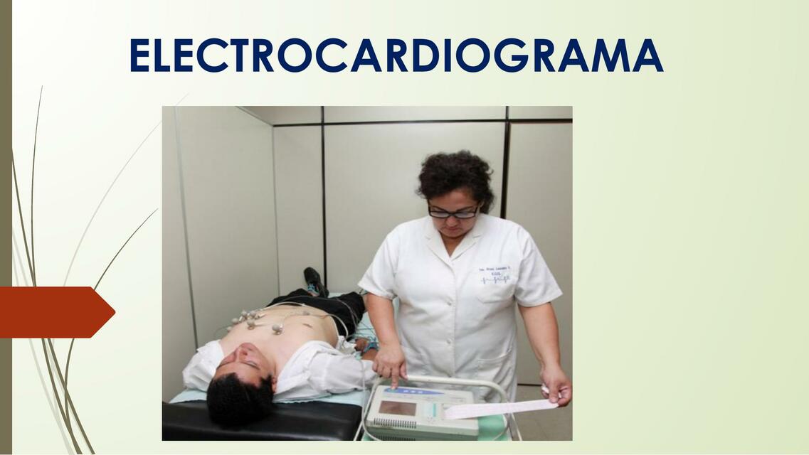 ELECTROCARDIOGRAMA | Gonzalo | uDocz