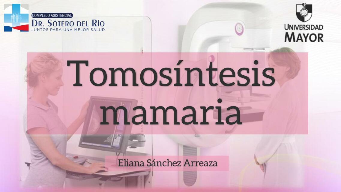 TOMOSINTESIS MAMARIA-ELIANA SÁNCHEZ ARREAZA | Eliana Sánchez | uDocz