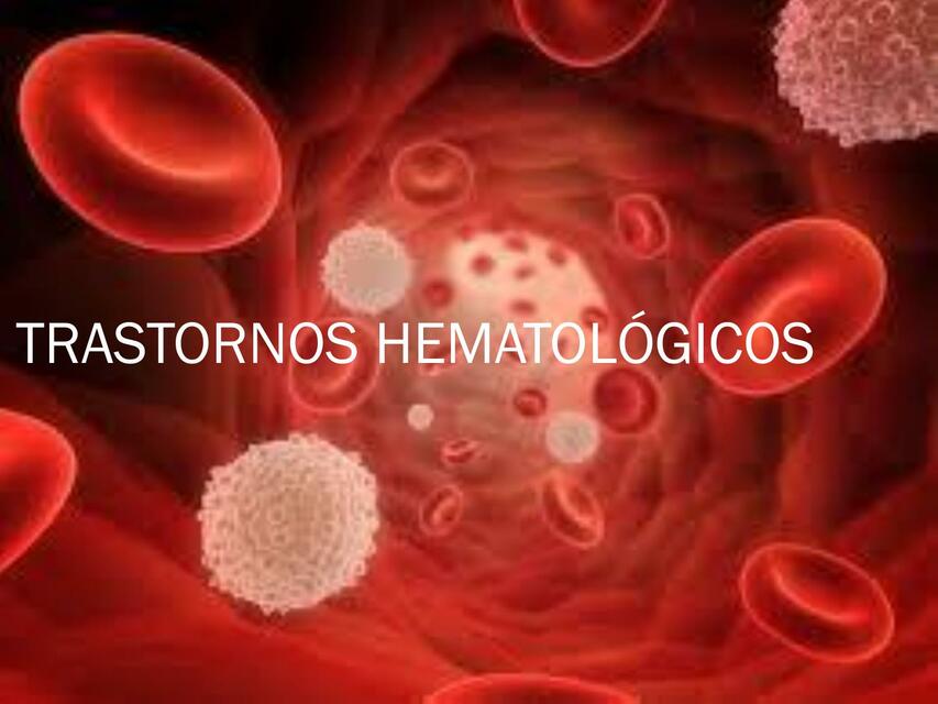 trastornos hematologicos | SOL | uDocz