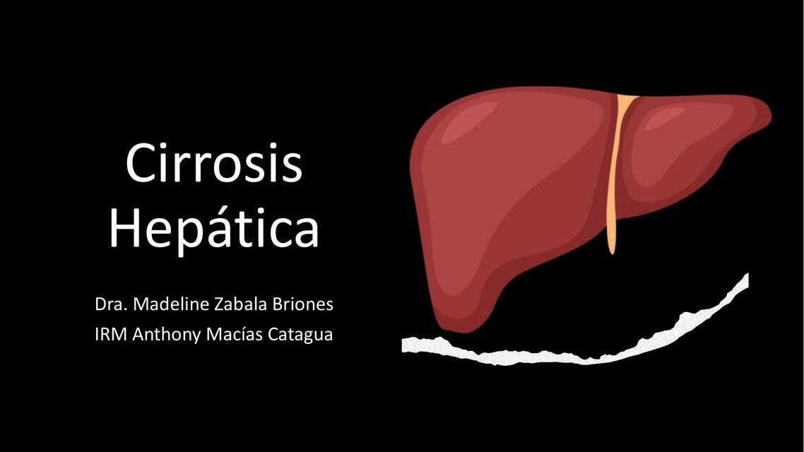 Flashcards de Cirrosis Hepática | Por David Macías | uDocz