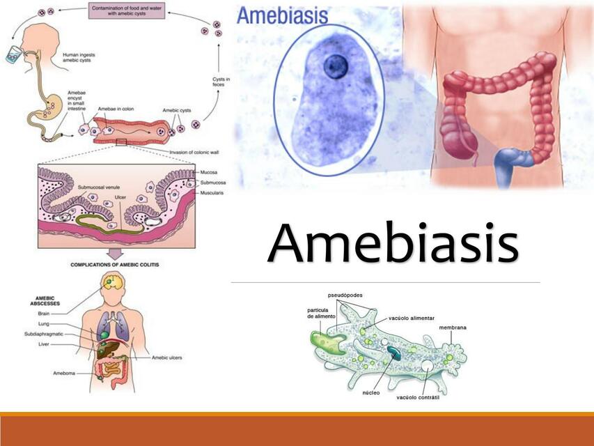 amebiasis intestinal | Dan | uDocz