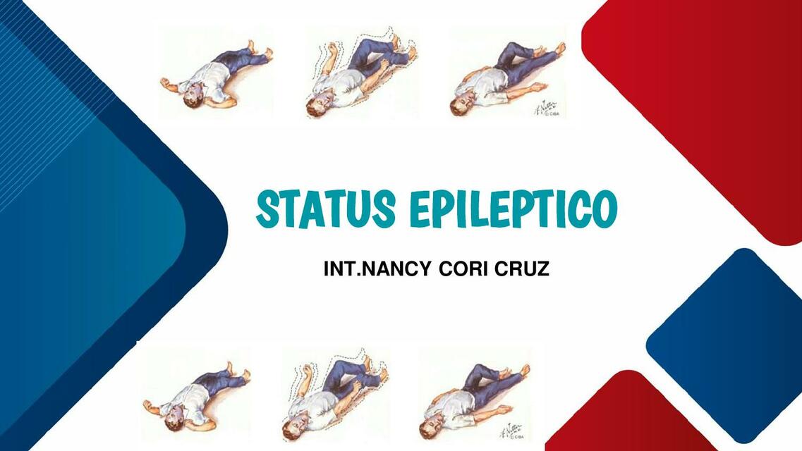Flashcards de Status epiléptico | Por Nancy | uDocz