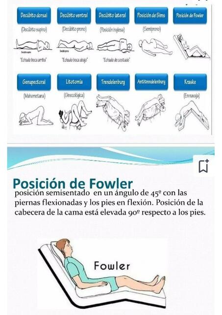 Posición de Fowler | ROSMERY | uDocz