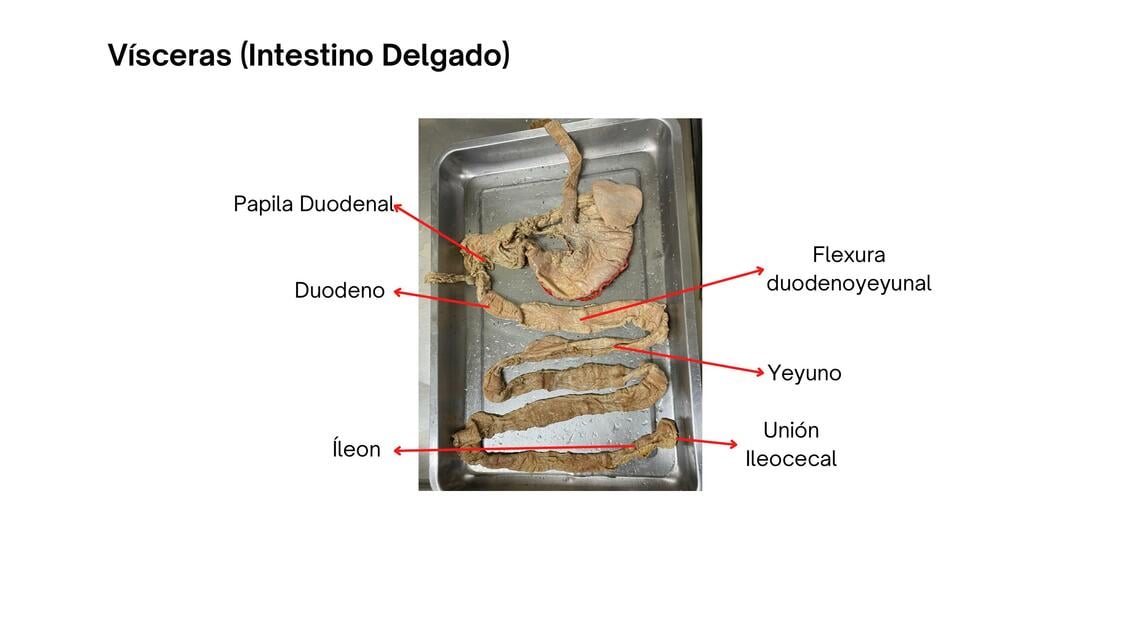 Práctica de anatomía ll Vísceras (Intestino Delgado y grueso) | LicMed ...