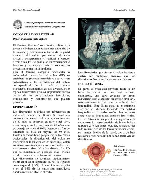 Colopatía diverticular CQFM | gprfil | uDocz