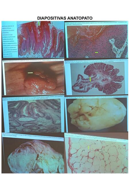 EXAMEN RECONOCIMIENTO DE PLACAS ANATOMIA PATOLOGICA DIAPOSITIVAS DRA ...