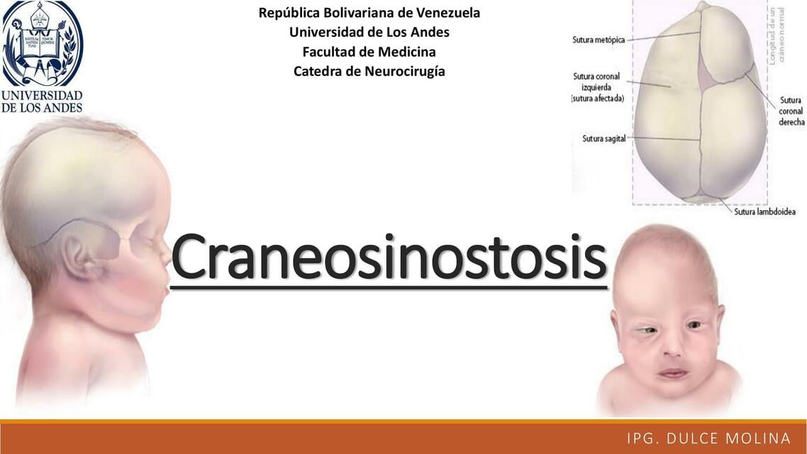 Tema 20 Craneosinostosis | ayudadita | uDocz