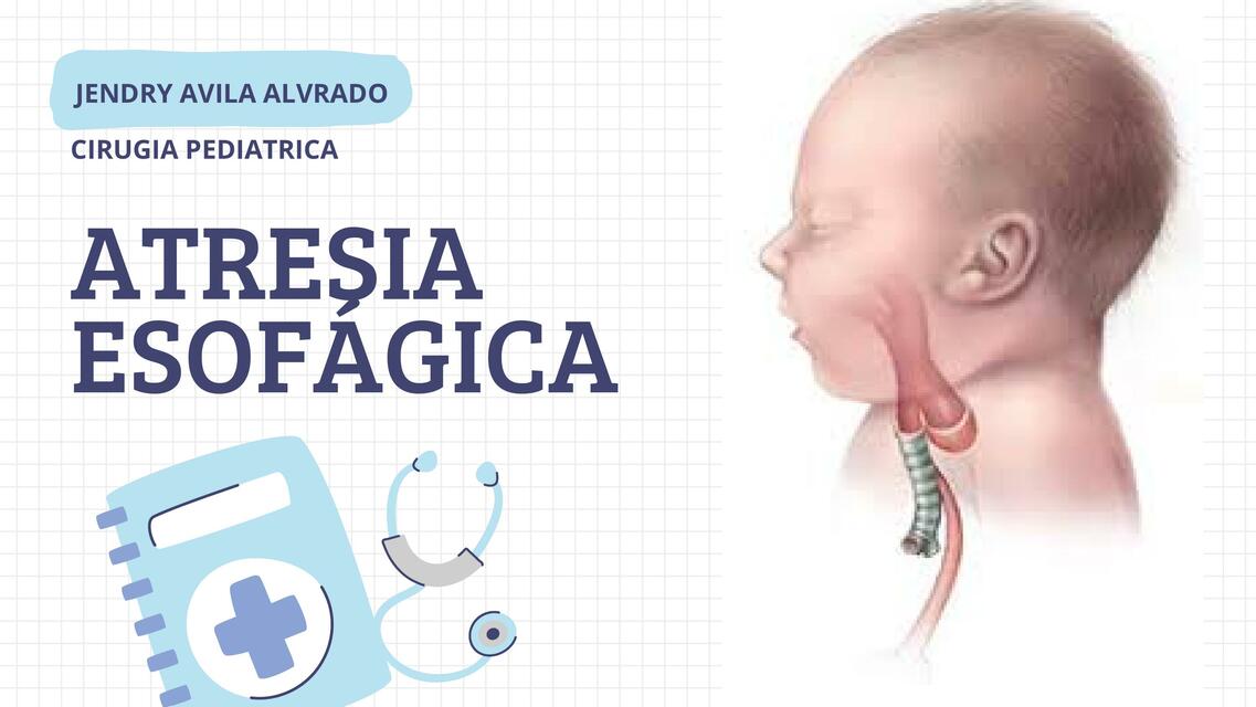 Flashcards de Atresia esofágica | Por JENDRY DEL PILAR AVILA ALVARADO ...