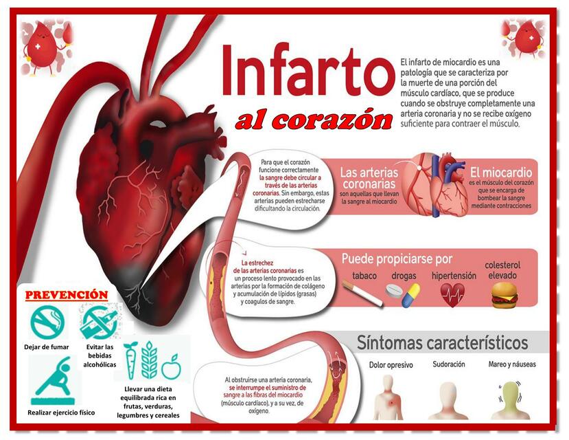INFOGRAFIA DE INFARTO AL CORAZON | Chioisabella Adrian | uDocz