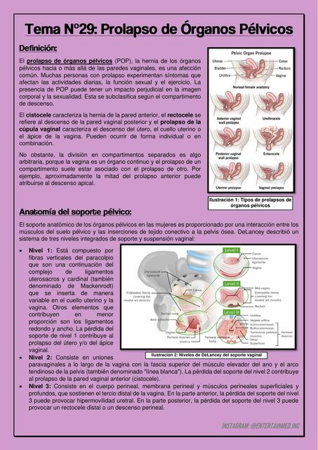 Prolapso de Órganos Pélvicos | EntertainMed.Inc | uDocz