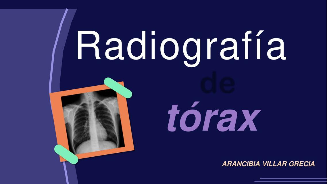 RX TORAX expo 1 | Gabriela Bazán | uDocz