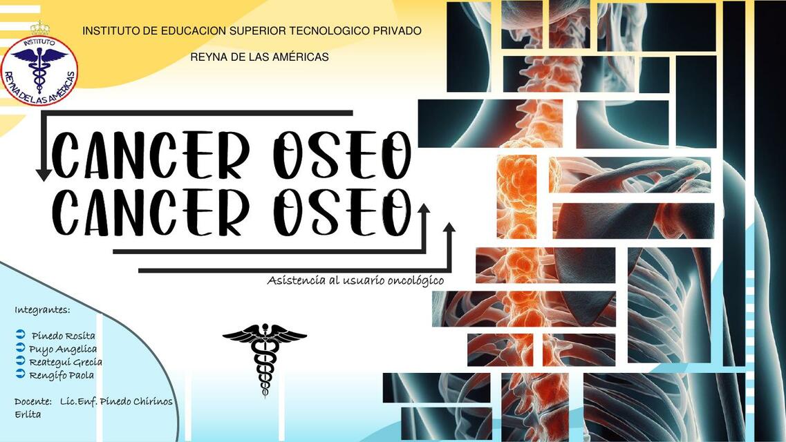 CANCER OSEO | Mariana Ruiz | uDocz