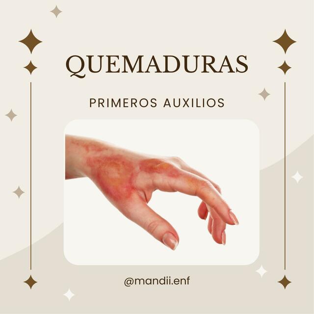 Quemaduras | AMANDA SOFIA | uDocz