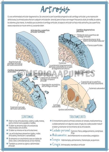 Artrosis | Moises Cruz | uDocz