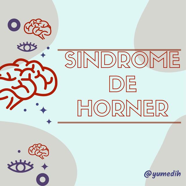 SINDROME DE HORNER | Yumedih | uDocz