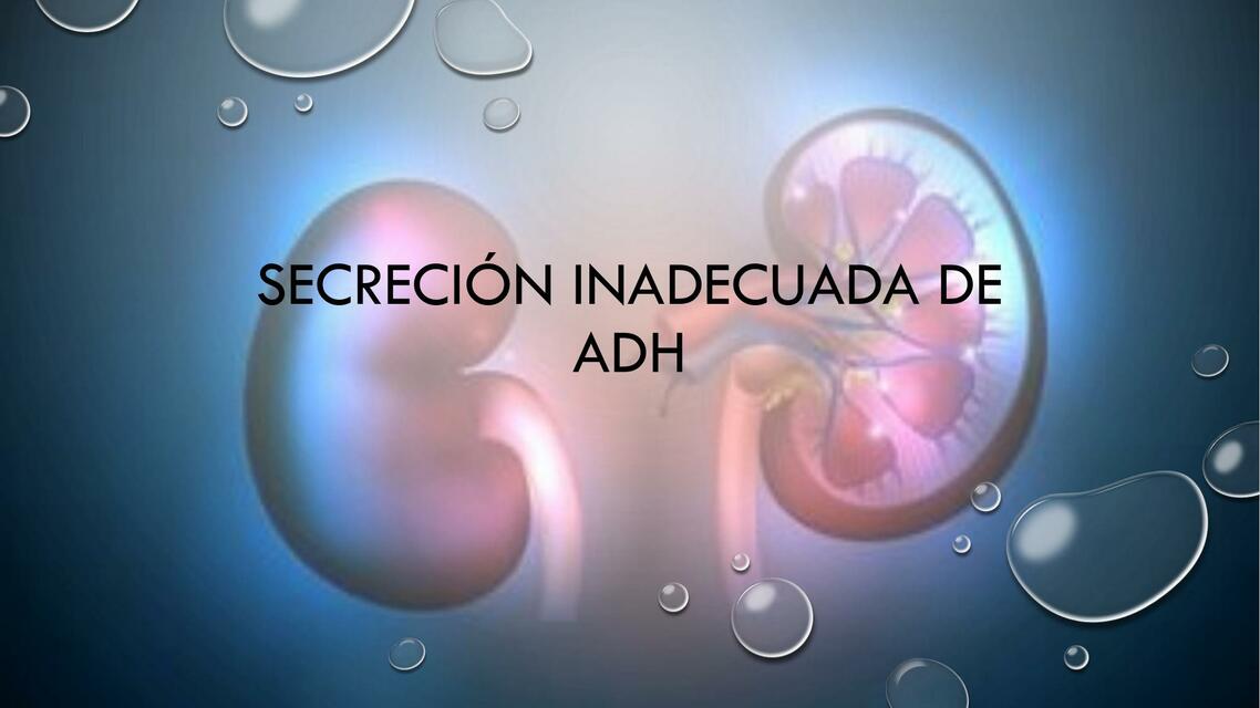 Secreción inadecuada de ADH | masiel | uDocz