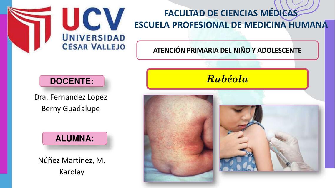 Rubeola | Maria Stefany Chuquitucto Torres | uDocz