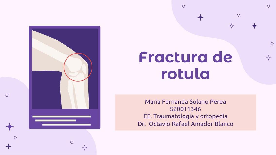 Flashcards de fractura de rotula | Por fer | uDocz