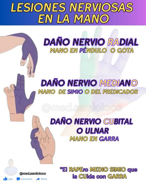 LESIONES NERVIOSA EN MANO | Víctor Rodriguez Botero - @med.semioloco ...