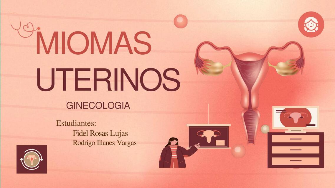 MIOMAS UTERINOS | Carlos Surita | uDocz