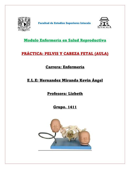 Práctica de Pelvis y Cabeza fetal | KEVIN ANGEL | uDocz