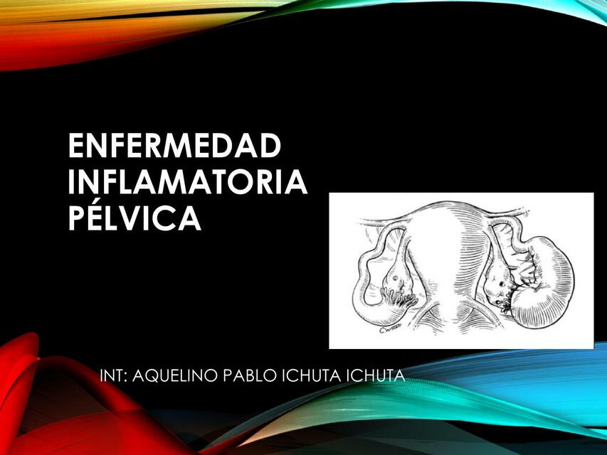 Enfermedad Inflamatoria Pelvica pablo | Pablo | uDocz