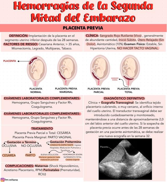 HEMORRAGIAS DE LA SEGUNDA MITAD DEL EMBARAZO | Dr. Boris Moises ...