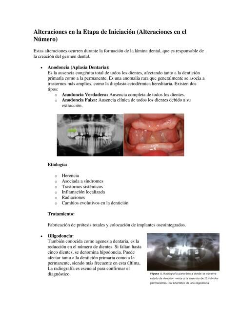 Alteraciones en el desarrollo dental | Giovana Sayuri Alvarez Lujano ...