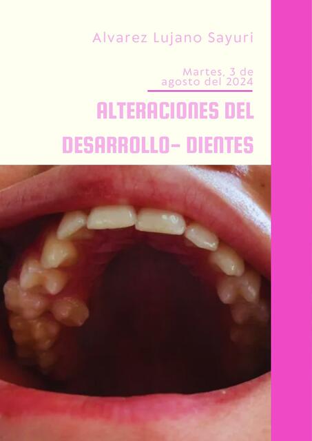 Alteraciones del desarrollo dental | Giovana Sayuri Alvarez Lujano | uDocz