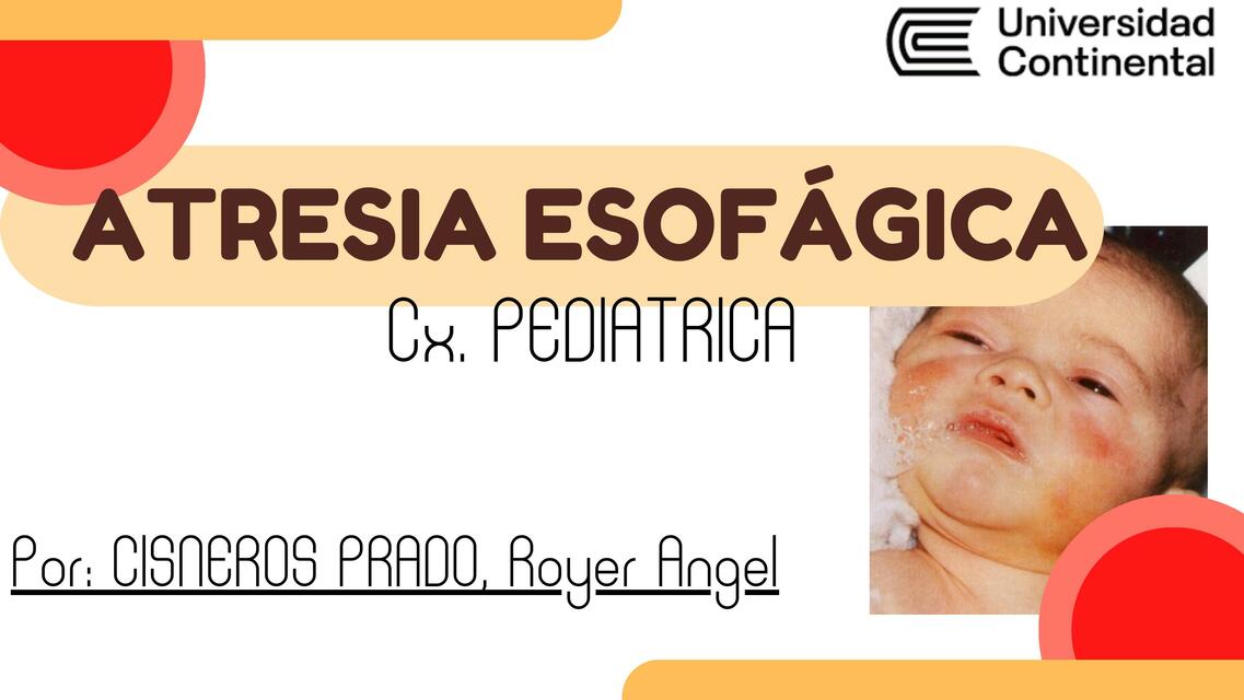 ATRESIA ESOFÁGICA | ROYER ANGEL CISNEROS PRADO | uDocz