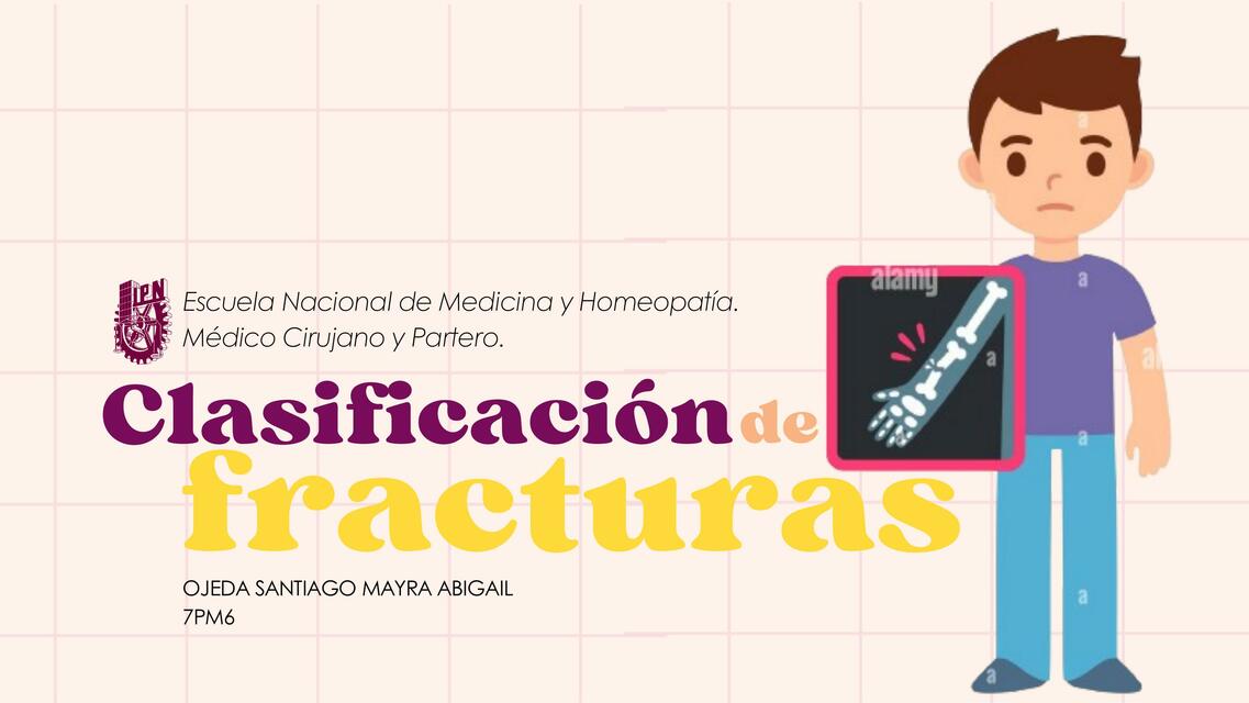 Clasificación de las fracturas | Mayra | uDocz