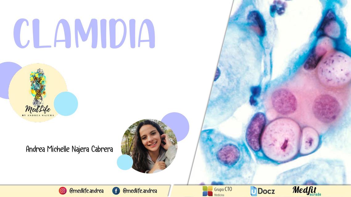 Clamidia | Medlife.andrea | uDocz