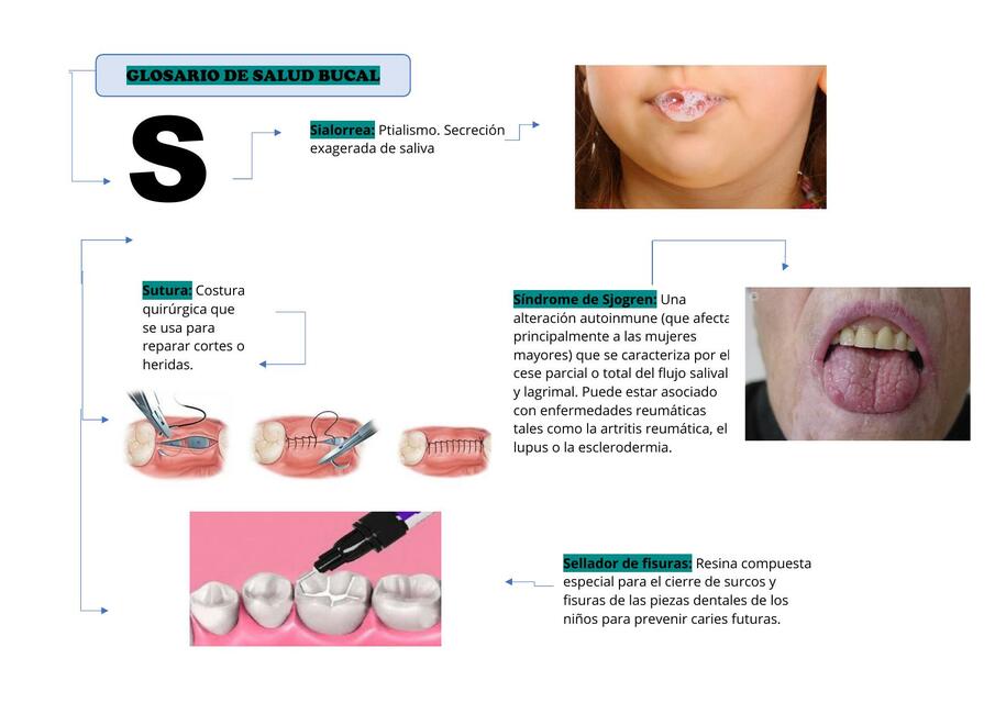 GLOSARIO S1 | Emily | uDocz
