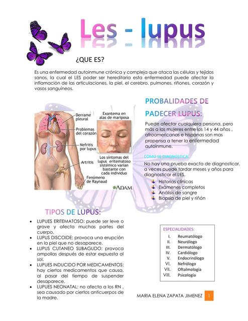 LUPUS | Maria | uDocz