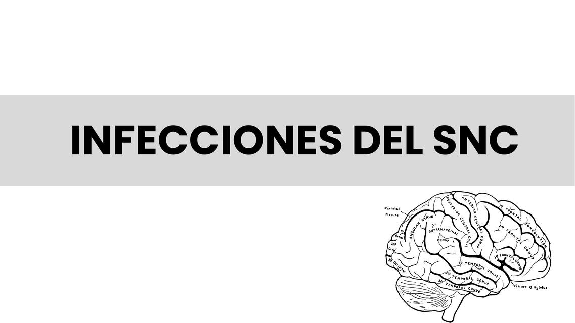 INFECCIONES SNC | KIARA MERINO | uDocz