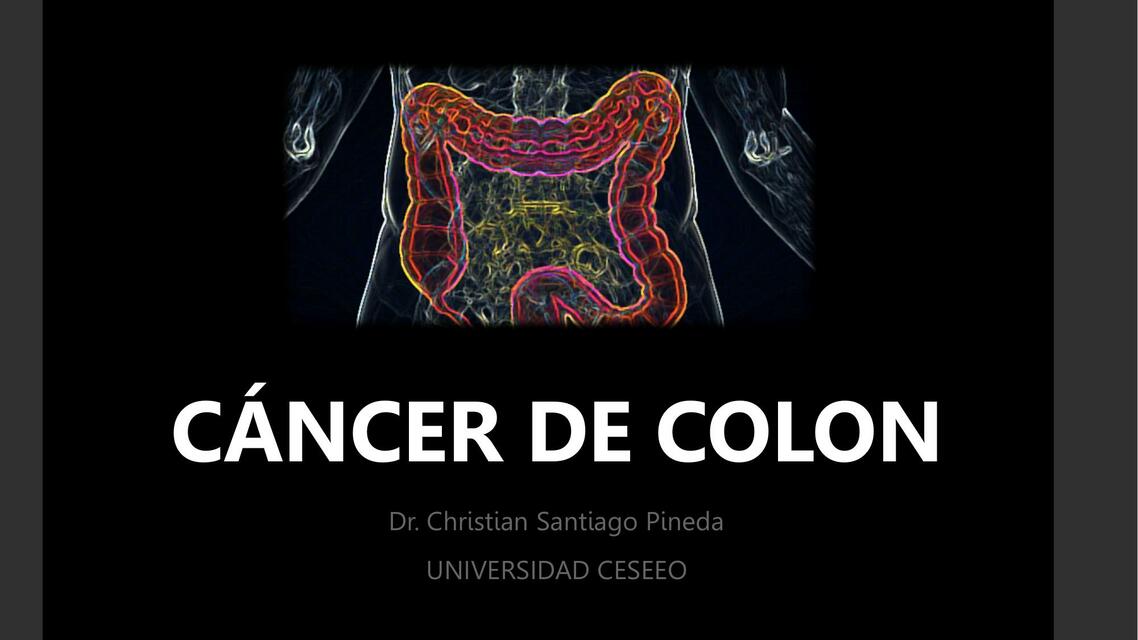 CA COLON Y POLIPOS 2 | Adrián | uDocz