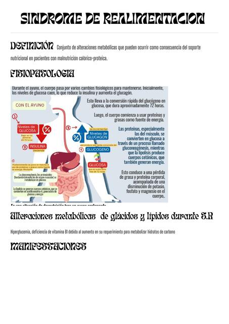 SINDROME DE REALIMENTACION | Maria isabel Diaz bautista | uDocz
