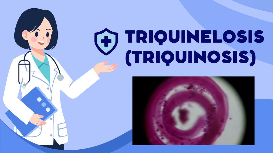 TRIQUINELOSIS TRIQUINOSIS 1 | MARÍA FERNANDA CASTILLO ALCÓCER | uDocz