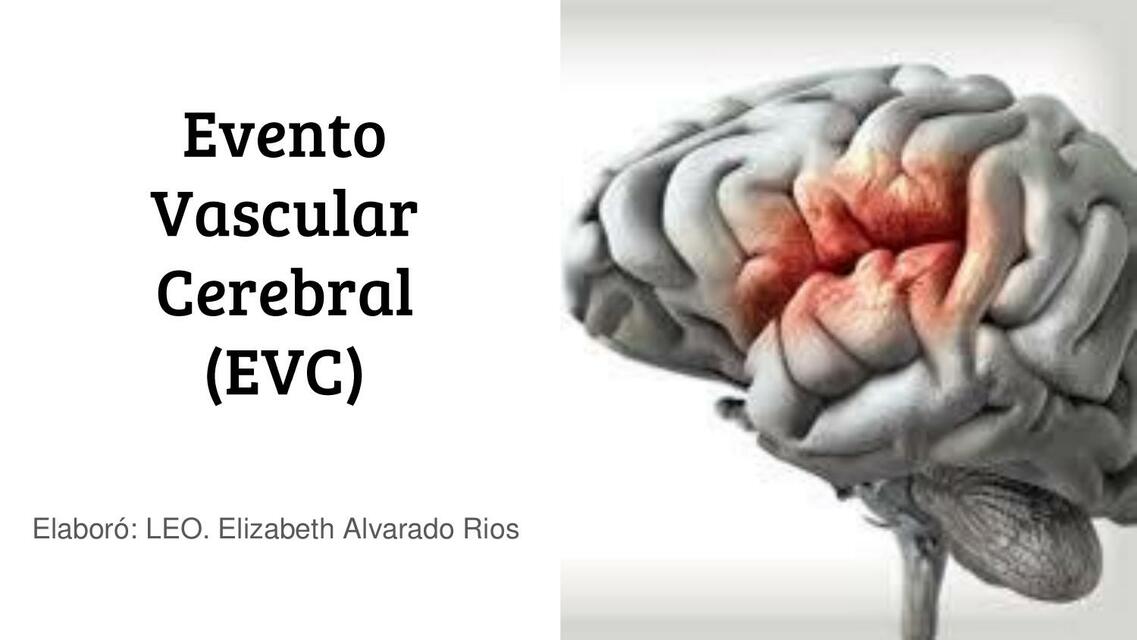 Evento Vascular Cerebral Evc Elizabeth Alvarado Rios Udocz