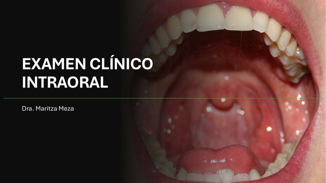EXAMEN CLÍNICO INTRAORAL | Giusseppe | uDocz