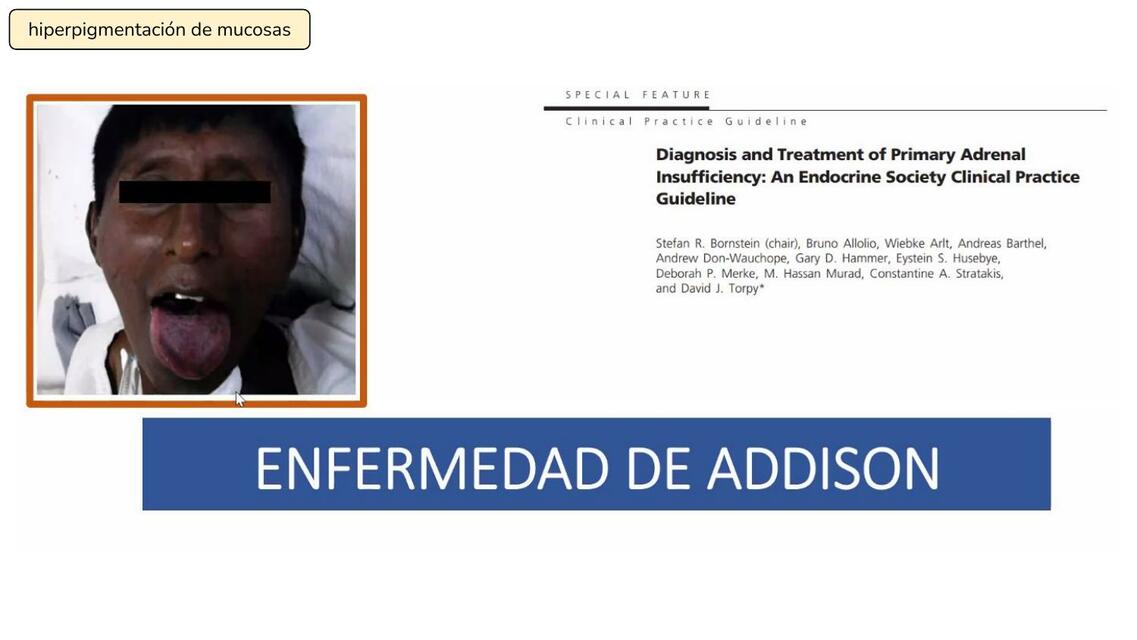 8.2. Enfermedad de Addison | LiquidOH愛 | uDocz