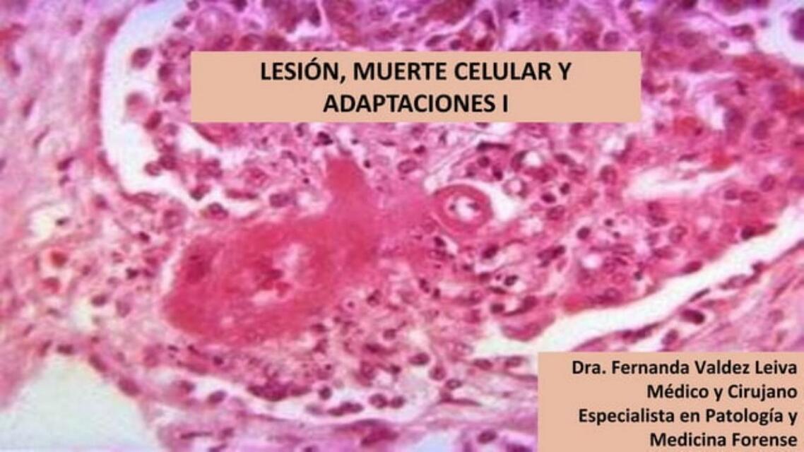 lesin muerte celular y adaptaciones ipptx | carlo | uDocz