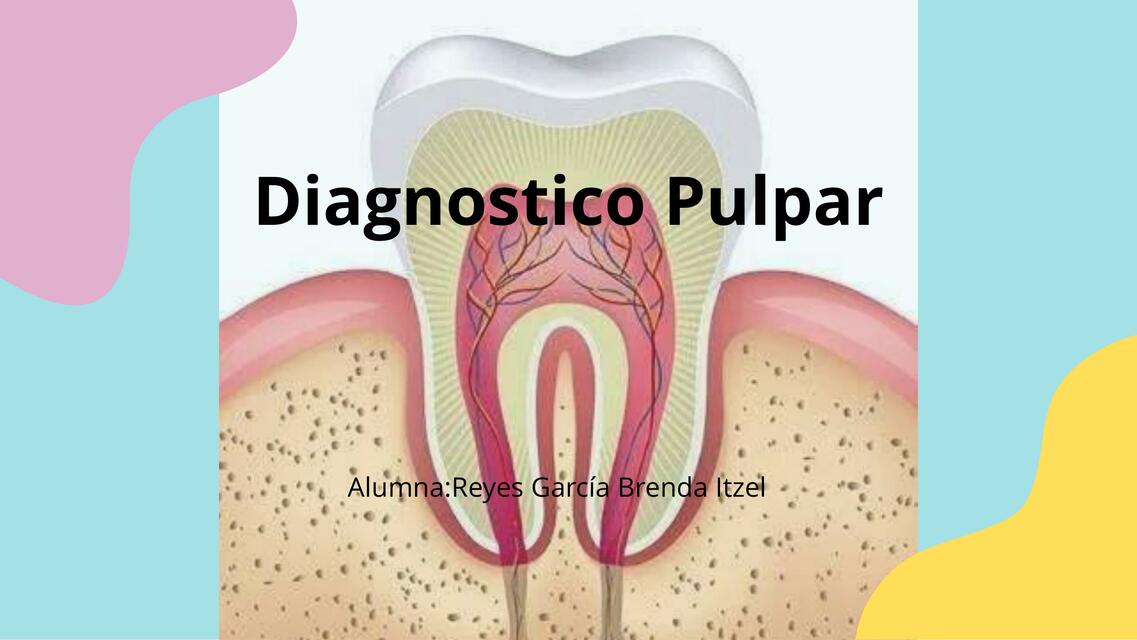 Flashcards de Diagnostico Pulpar | Por Brenda reyes | uDocz