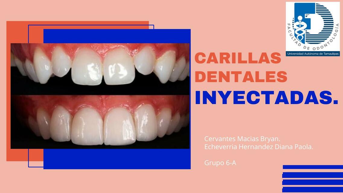 CARILLAS INYECTADAS | Gabriela | uDocz