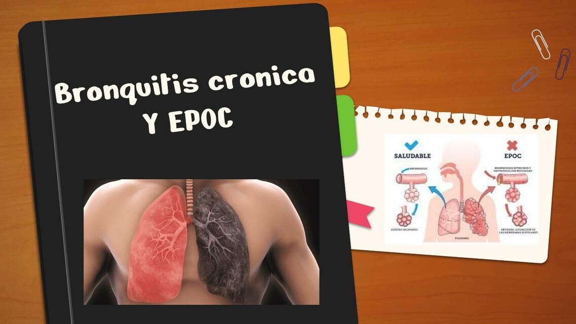 Bronquitis cronica y EPOC | Luis Eduardo | uDocz