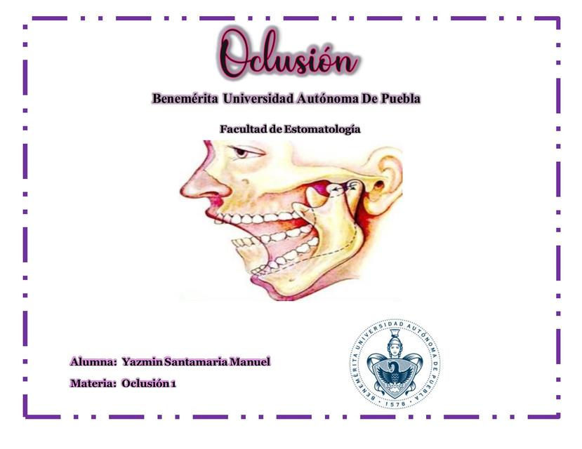 Oclusión | Yazmin Santamaria Manuel | uDocz