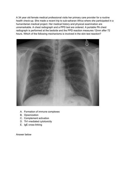 PPD test | Iván Ayala Collado | uDocz