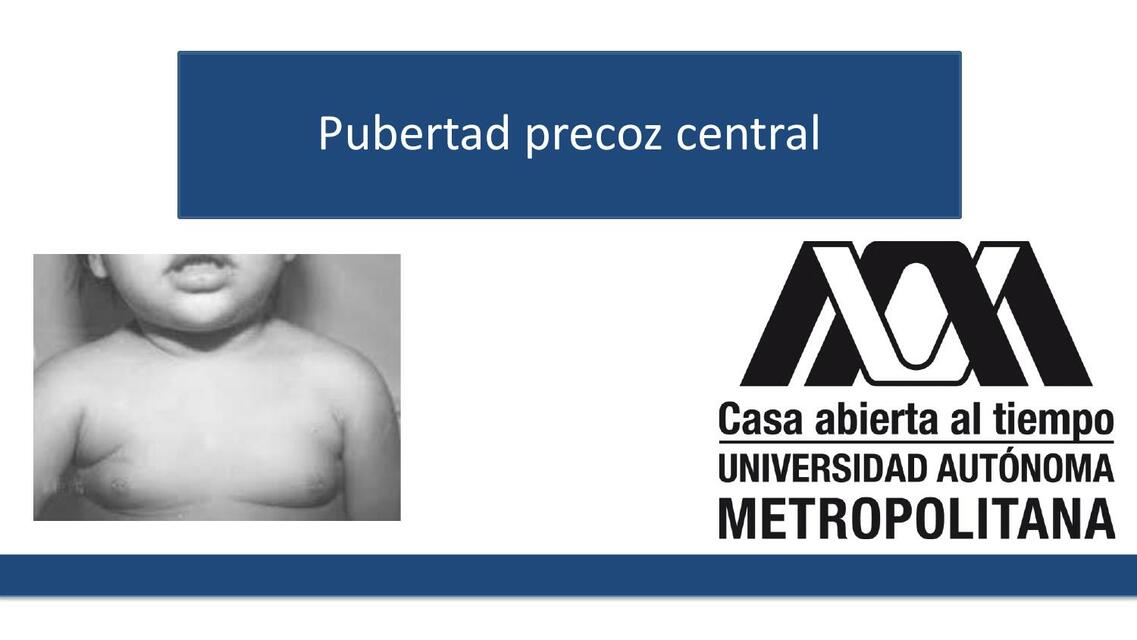 pubertad precoz central | Berenice Bravo Martinez | uDocz